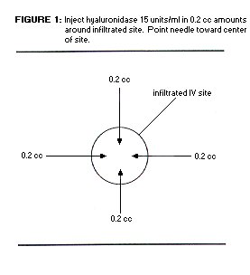 Iv Infiltration Diagram