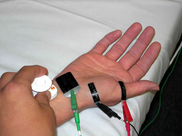 Emg Nerve Test On Hands What Does An Emg Diagnose QEQ emg-nerve-test-on-hands-what-does-an-emg-diagnose-qeq